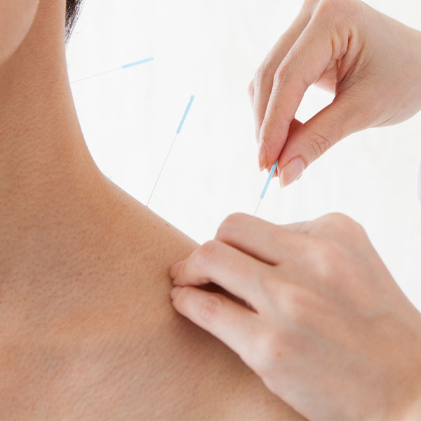 Chelsea Chiropractor - Accepting New Patients - Chelsea Chiropractic ...